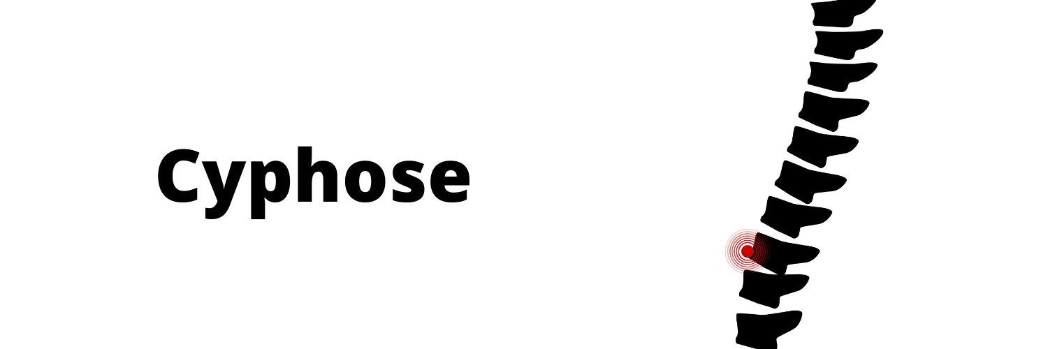 Siège ergonomique pour le dos pour lutter contre la Cyphose