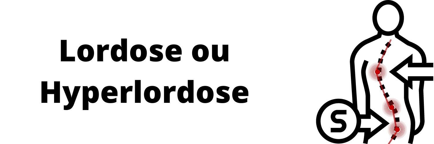 LORDOSE ou HYPERLORDOSE - Solution Ergonomiques